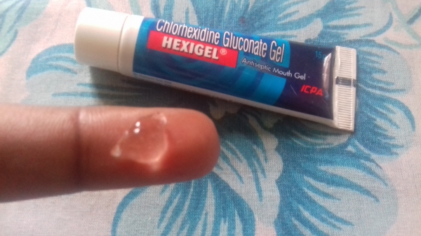 Hexigel (Chlorhexidine Gluconate) Antiseptic Mouth Gel review